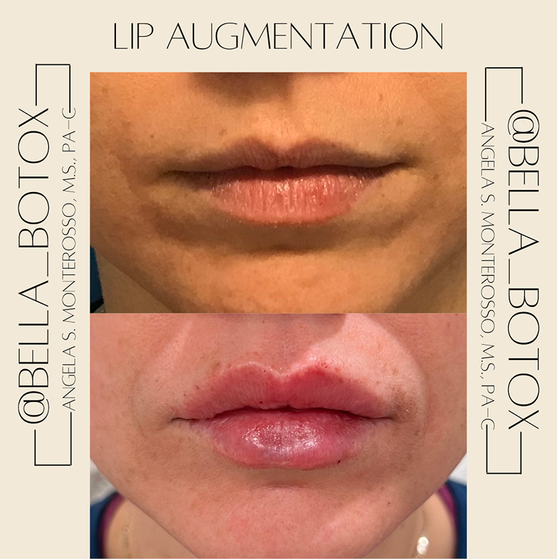Premier Cosmetic Surgery in New York | Medique NYC